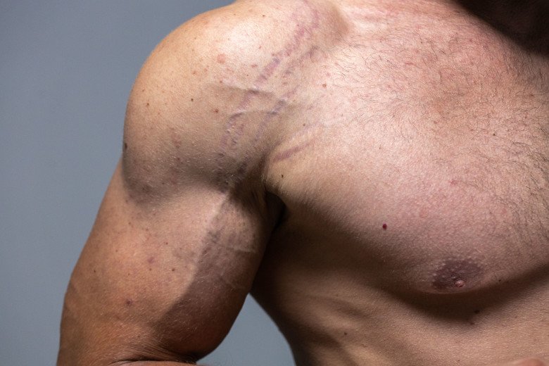 Cómo eliminar la grasa del pecho de forma efectiva | Gentleman USA